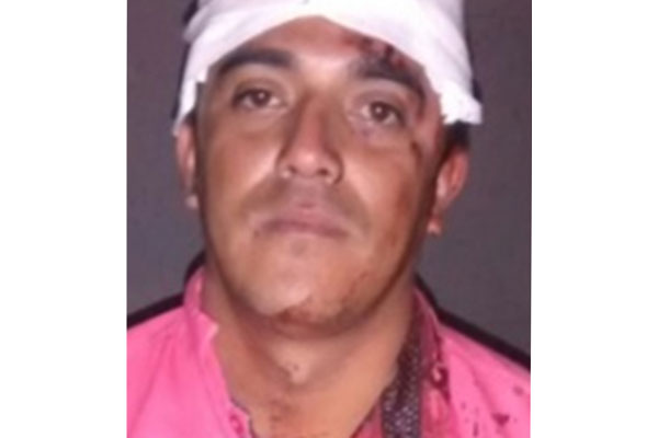 Estatales Capturan a Conflictivo Sujeto Porque fue Descalabrado en Riña ...